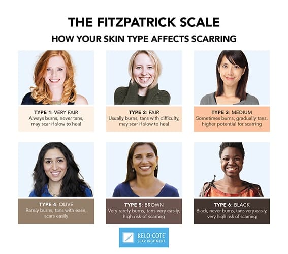 Fitzpatrick Skin Types The Devonshire Clinic Fitzpatrick Skin Types The Devonshire Clinic