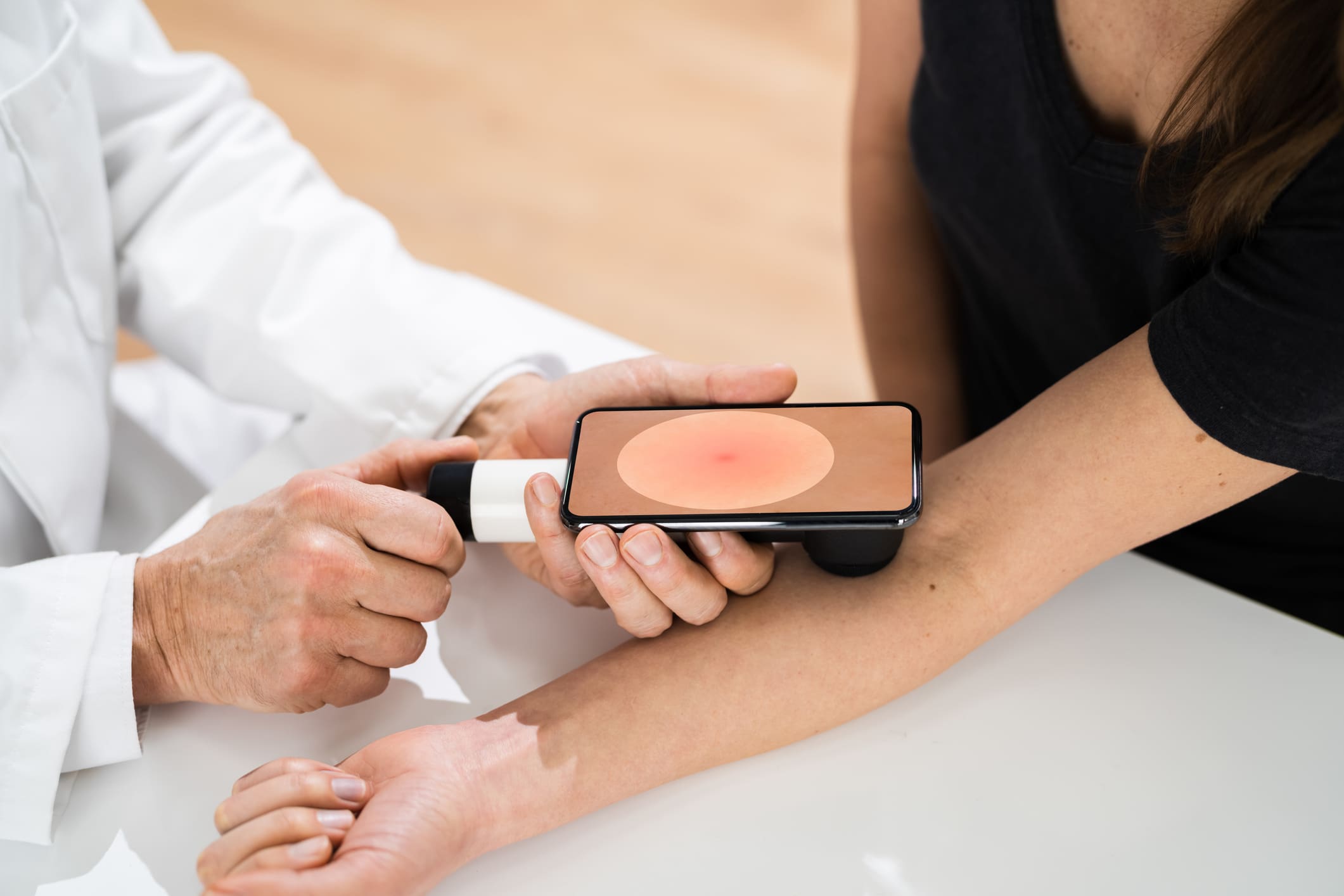 What is Teledermatology? How Remote Skin Cancer Checks Work