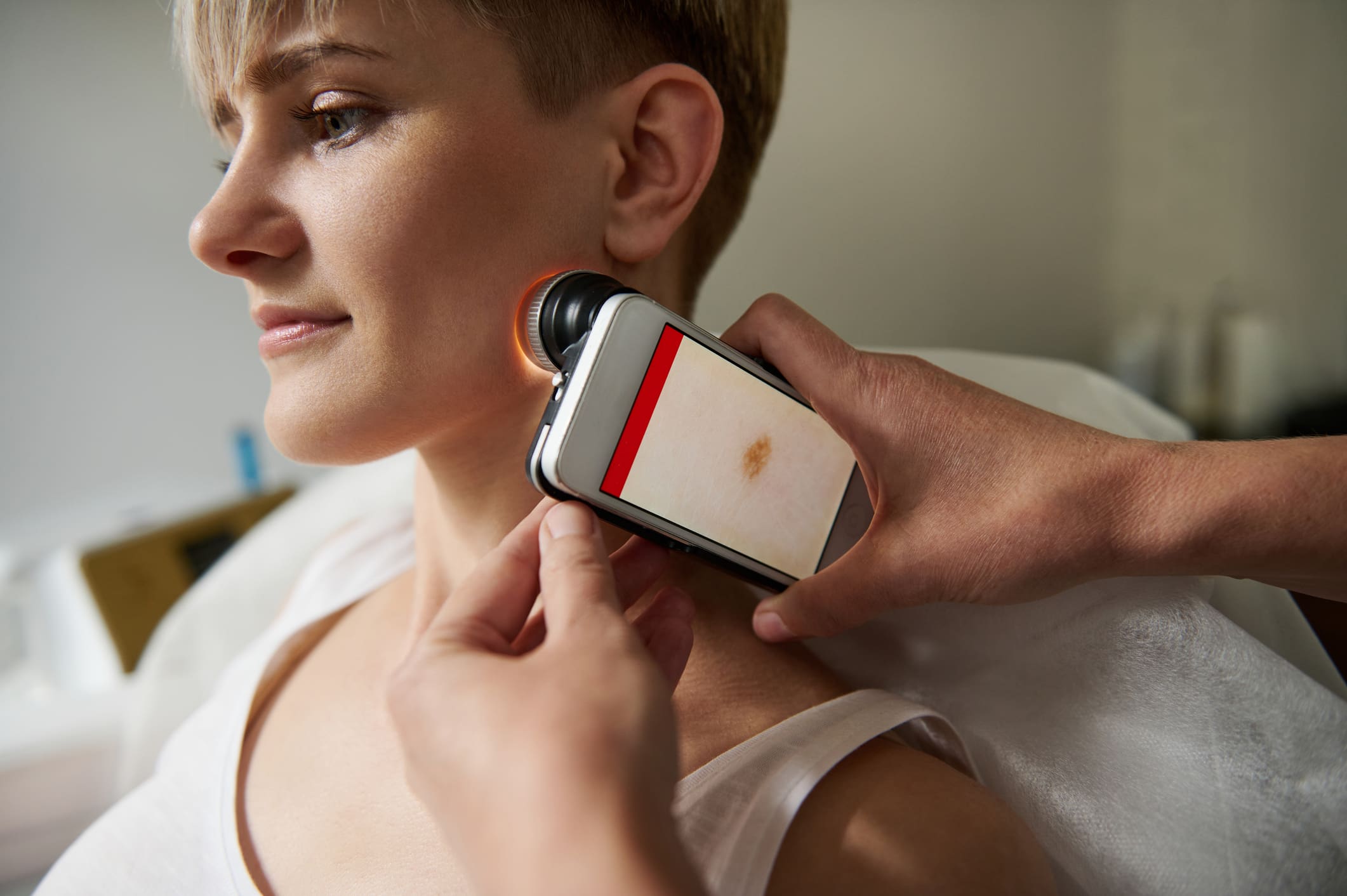 How AI Is Transforming Skin Cancer Detection